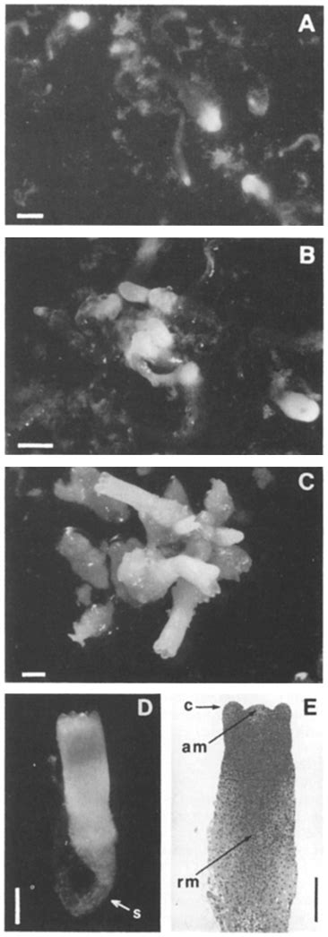 Development Of Norway Spruce Embryos Plated In A Thin Layer Of Agarose