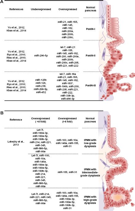 Panin A And Ipmn B Progression Models And Corresponding Mirna