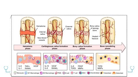 Fraktur Tibia Fisiologi Anatomy Assessmrnt Pdf