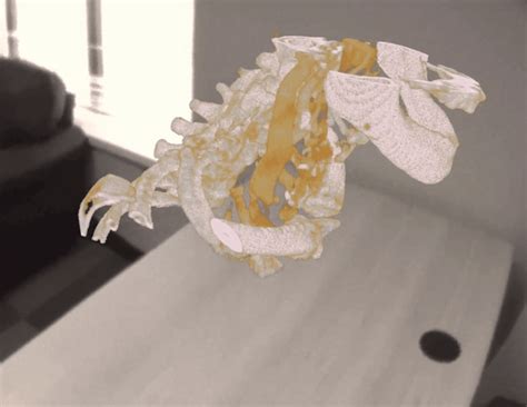 Kitware Inc On Linkedin Ar Xr Vtk Vtkjs Medicalvisualization Medicalimaging