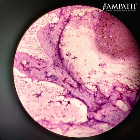 Ampath American Institute Of Pathology And Laboratory Sciences On