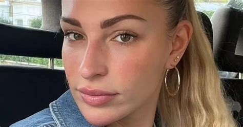 Zara Mcdermott Reveals Her Facial Transformation As She Opens Up On