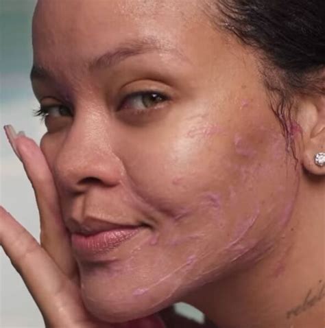 Rihanna Shows Of Natural Skin Texture In Super Satisfying Skincare