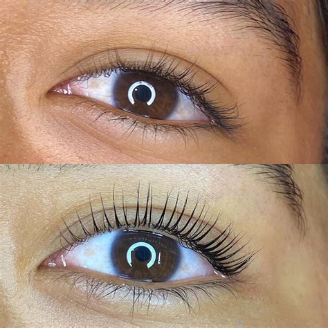 What Is Lash Botox Detailed Guide To The Treatment