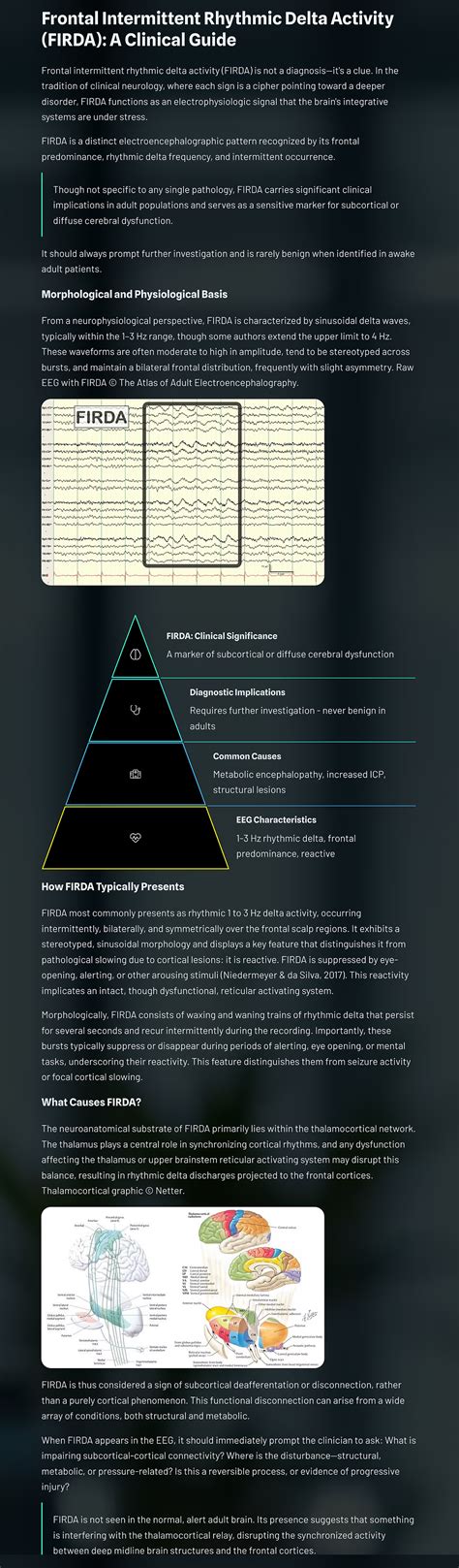Interpreting The Raw Eeg Frontal Intermittent Rhythmic Delta Activity Firda