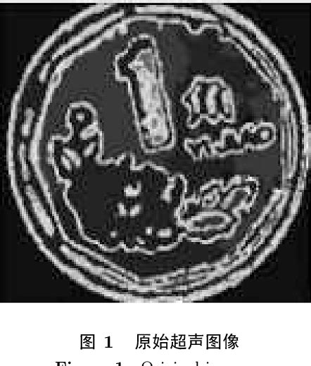 Figure 1 From The Performance Of Reconstruction Ultrasound Imaging