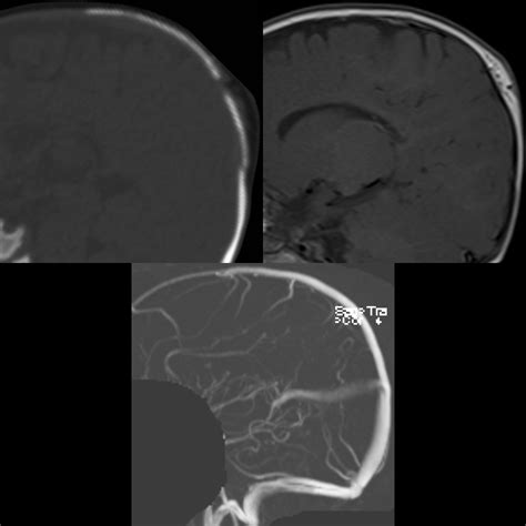 Infant With An Occipital Mass Pediatric Radiology Case Pediatric
