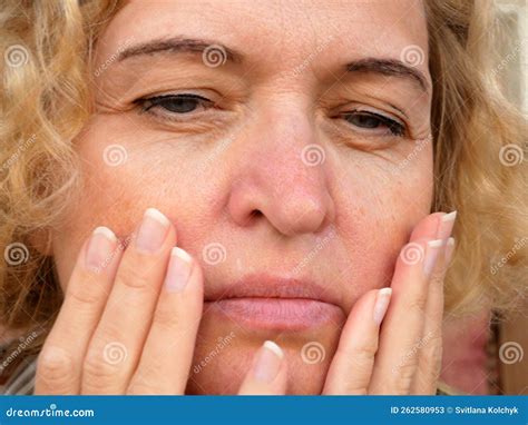 Middle Aged Female`s Eye With Drooping Eyelid Making Facial Massage