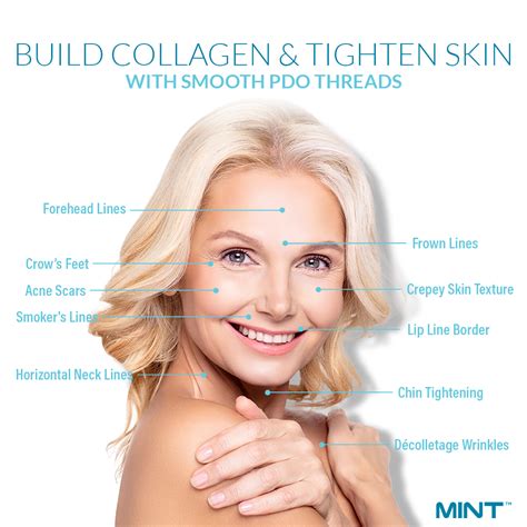 Mint™ Pdo Thread Lift Your Aesthetic Journey Portland Or