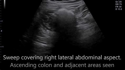 Abdominal Ultrasound Examination Survey Fusion Radiology