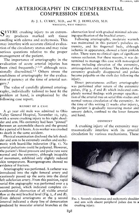 Arteriography In Circumferential Compression Edema Ajr