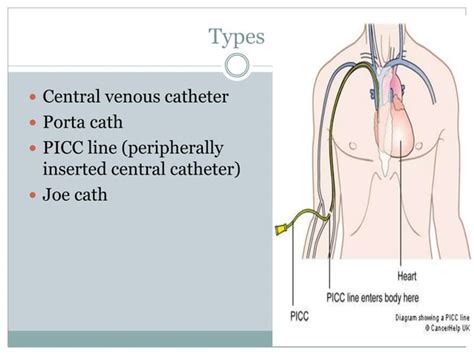 Care Of Patient With PICC Line And Central Pptx First Aid Injuries