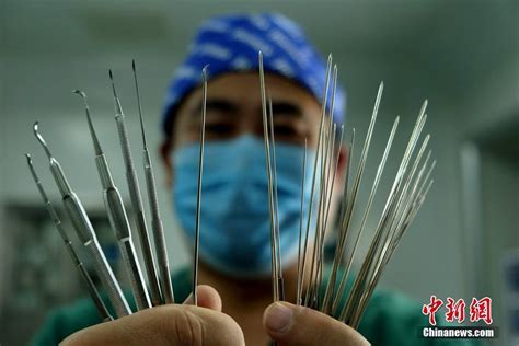 探访中医特异针疗法中华钩活术 中国侨网