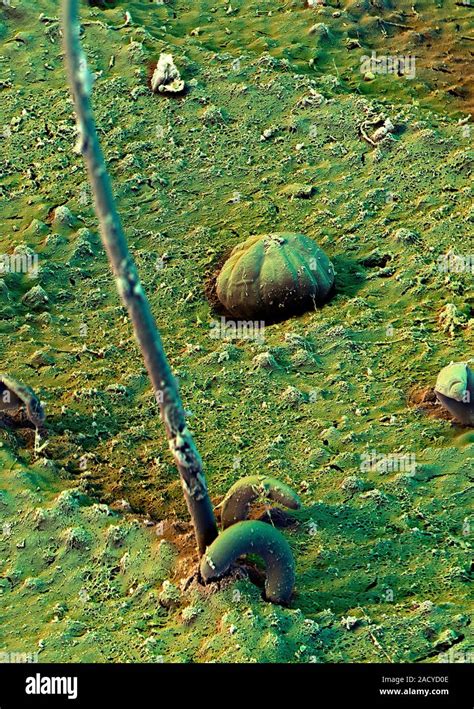Macaranga Leaf Trichomes Coloured Scanning Electron Micrograph Sem