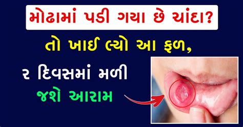 પેટની ગડબડને લીધે મોઢામાં પડી ગયા છે ચાંદા તો બજારમાં વર્ષ દરમિયાન