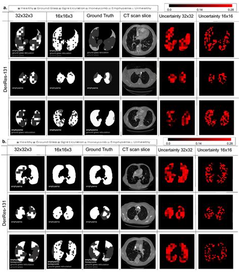 The Multi Classification Results Of Six Different Patients Of The Download Scientific Diagram