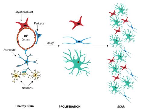 Cartoon Depicting The Role Of Astrocytes In The Healthy And Injured