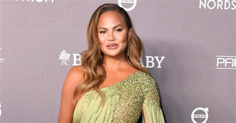 Chrissy Teigen Reveals She Underwent Procedure To Have Fat Removed From