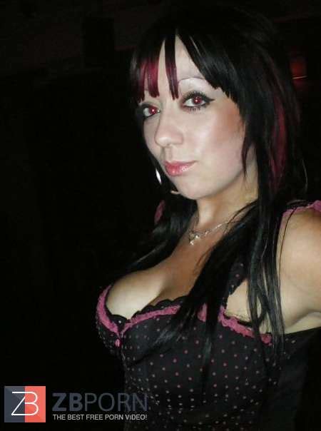 Phat Congenital Facebook Mounds Zb Porn