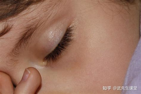 为什么半夜2、3点总会“自然醒”？中医提醒：原来身体这几处堵了 知乎