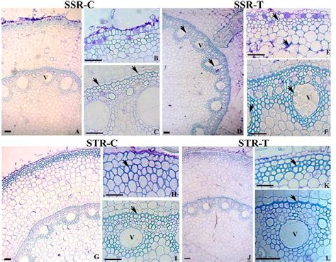 Figure From Root And Leaf Anatomy Ion Accumulation And Transcriptome Pattern Under Salt