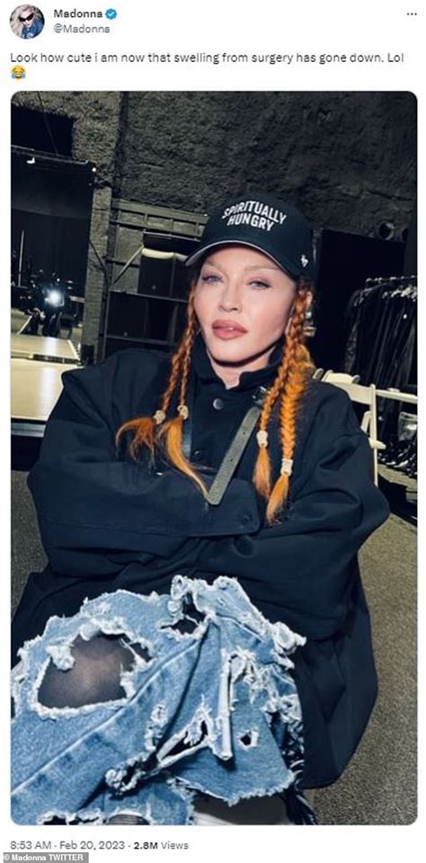 Singer Madonna Admits To Plastic Surgery After Her Unrecognizable