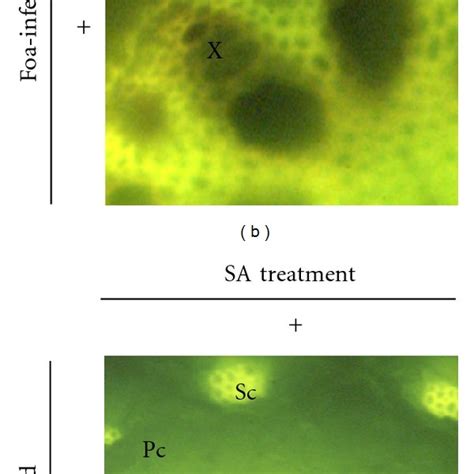Histochemical Localization Of Caffeic Acid Derivatives And Flavonoids Download Scientific