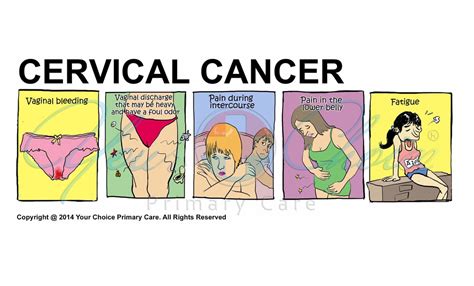 CervicalCancer Your Choice Primary Care You Choi MD Internal Medicine