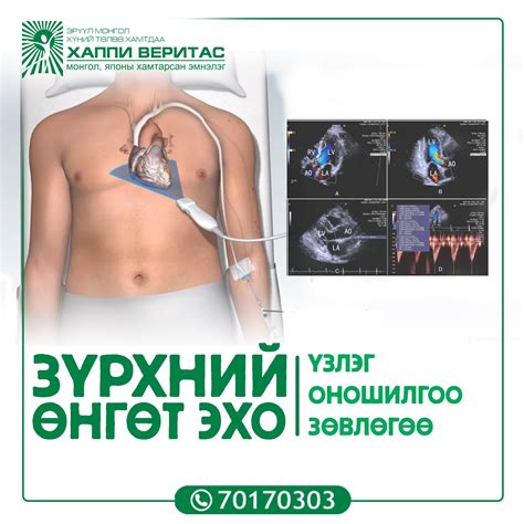 👩‍🔬Зүрхний ЭХО оношилгоо болон үзлэг зөвлөгөө хийж байна ☝️Зүрхний
