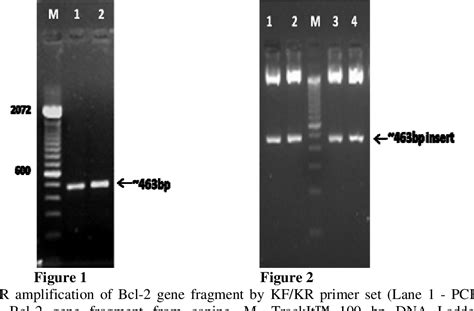 figure 1 from cloning sequence analysis and structure prediction of b