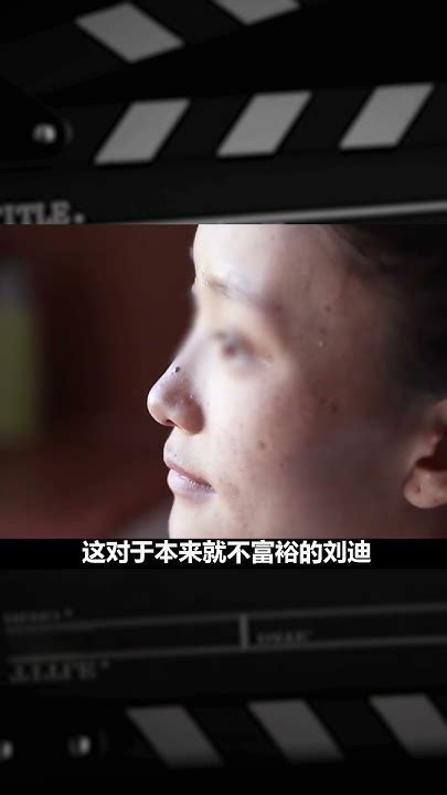 女孩患上“蟲癌”，醫生開刀一看，肝臟爬滿重達兩斤蟲子 电视剧 Drama Chinese Drama 偶像 言情 Youtube