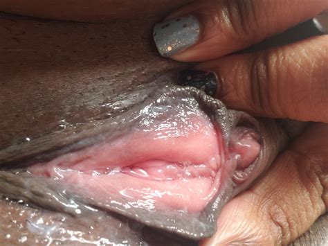 Varieties Of Vaginas Page 11 Xnxx Adult Forum