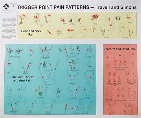 Travell And Simons Trigger Point Pain Patterns Wall Charts Amazon Com Br