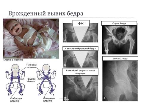 Переломы Вывихи презентация онлайн