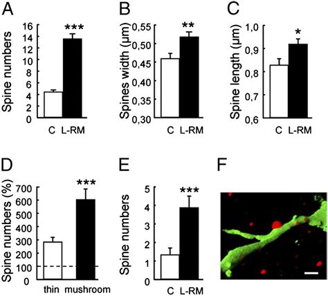 Dendritic Spines Learning