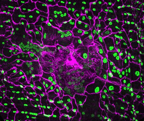 Polyploid Cells Which Have Extra Copies Of Their Genomes May Help