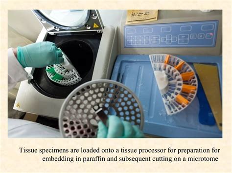 Tissue Processing In Histopathology Ppt