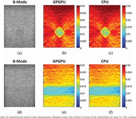 Figure 10 From A Hybrid Cpu Gpgpu Approach For Real Time Elastography
