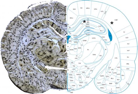 Evaluation Of Dendrite Morphology In Wistar And Genetic Absence Epileptic Rats Brain Structure