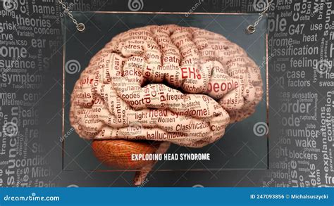Exploding Head Syndrome In Human Brain Stock Illustration Illustration Of Human Terms 247093856