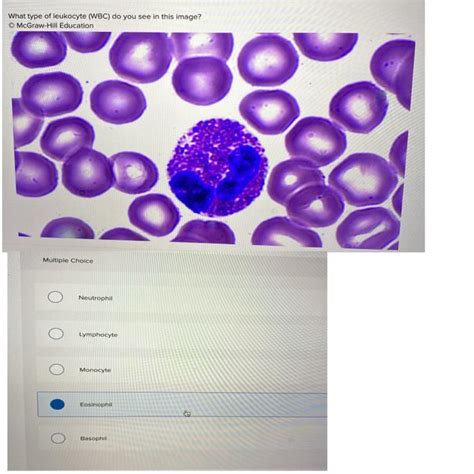 Solved What Type Of Leukocyte WBC Do You See In This Chegg