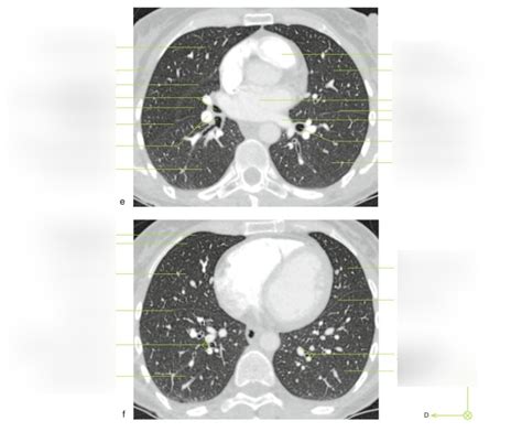 Coupes Thorax 3 Diagram Quizlet