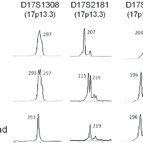 Polymorphic Dna Marker Analysis On The Dna Extracted From The Bloods Of