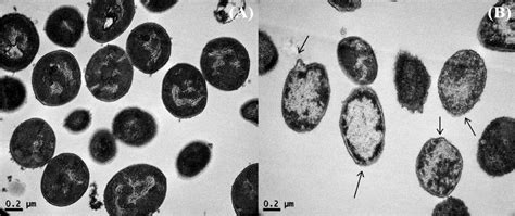Transmission Electron Micrograph Of S Intermedius A Untreated