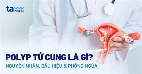 Polyp T Cung Nguy N Nh N D U Hi U Ch N O N V Ph Ng Ng A