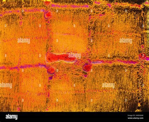 False Colour Transmission Electron Micrograph Tem Showing The