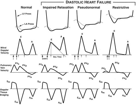 Frontiers Assessment Of Diastolic Function In Congenital Heart Disease