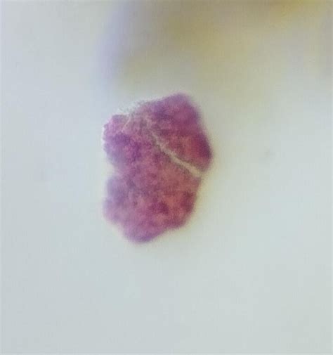 Can Anyone Help Me Identify Any Of These R Microscopy