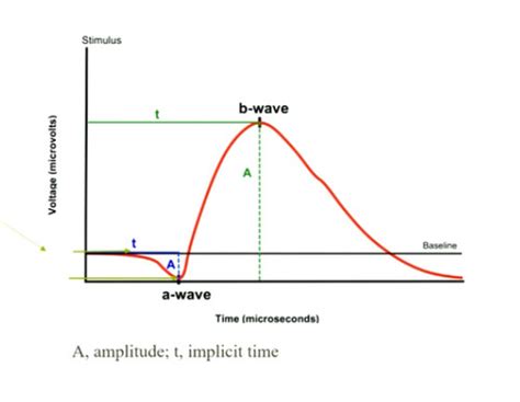 Vsp Visual Electrophysiology Flashcards Quizlet