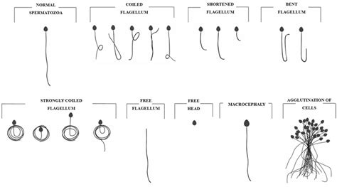 Illustration Designed To Represent Each Morphological Classification